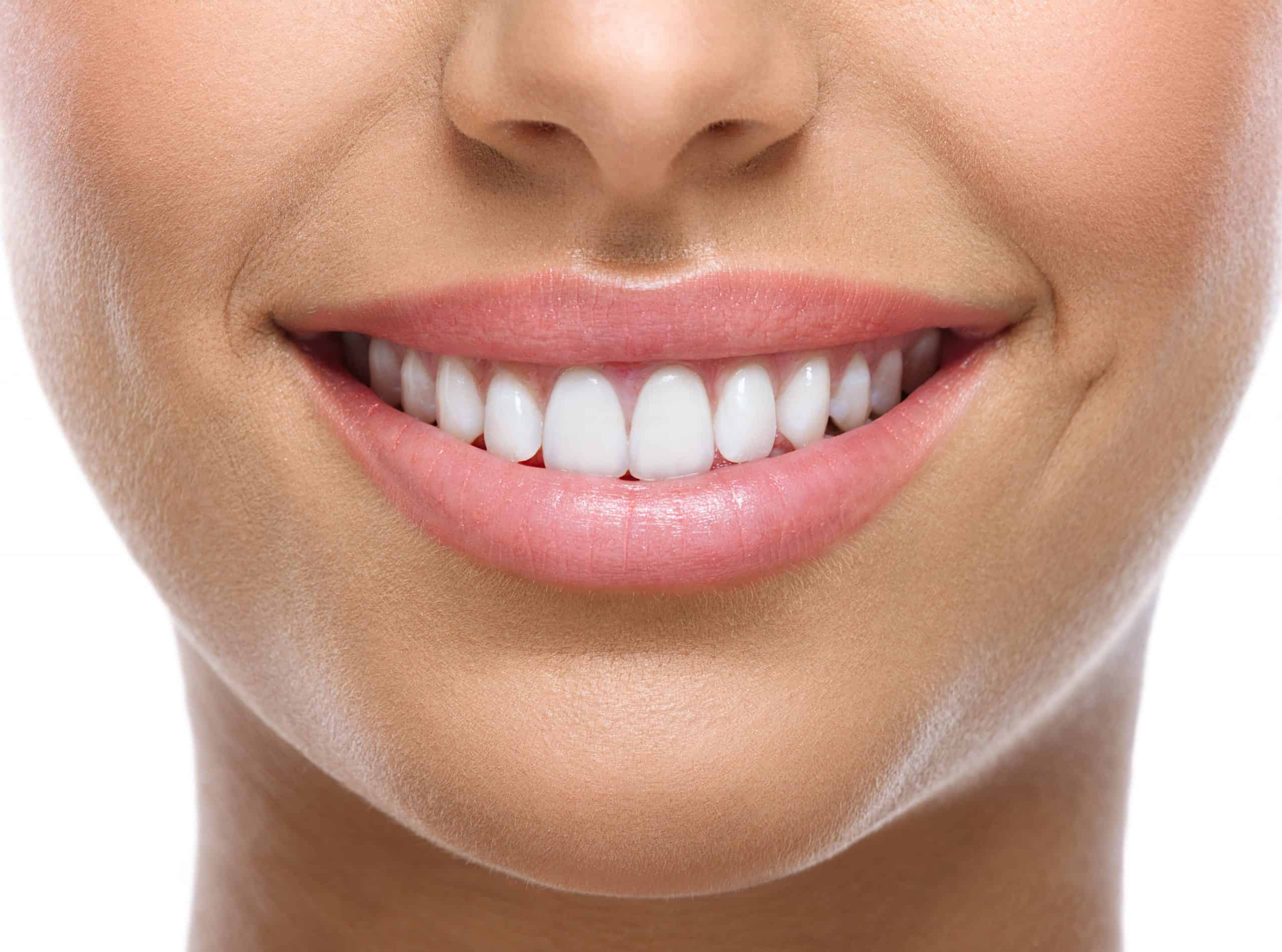 5 Guaranteed Ways to Get That Perfect Hollywood Smile - YeyeLife