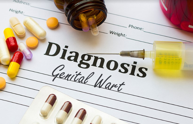 3 Common Misconceptions About Pearly Penile Papules - YeyeLife